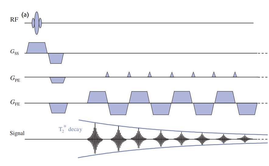 The Sounds of MRI | UCSF Larson Advanced Imaging Group